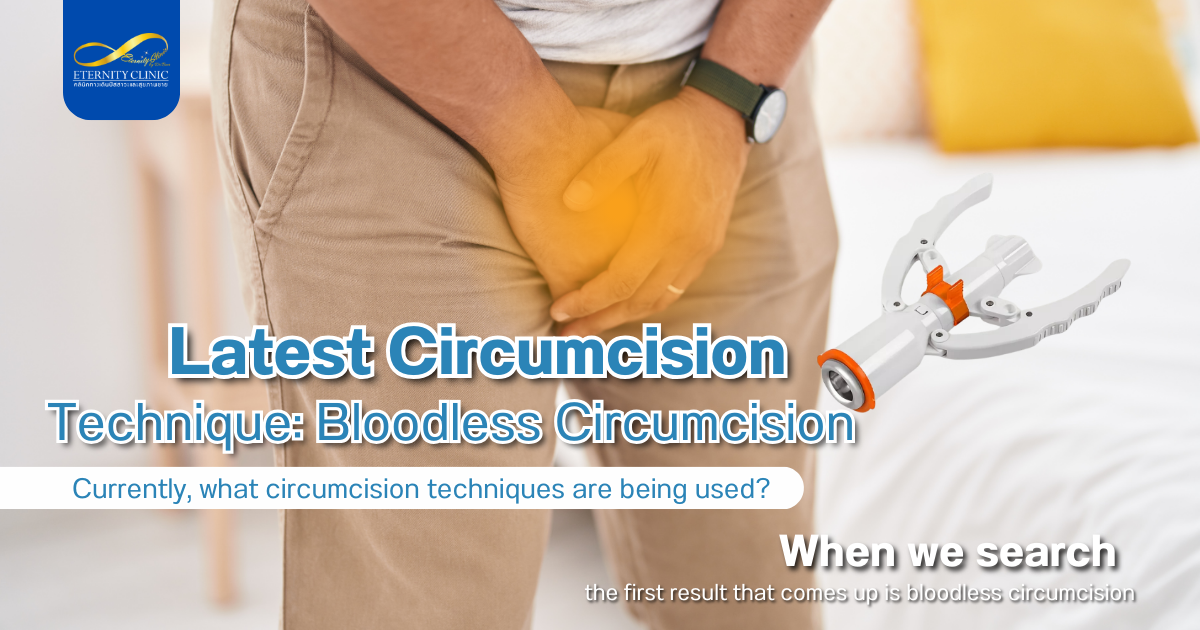 Latest Circumcision Technique: Bloodless Circumcision - ETERNITY CLINIC ...