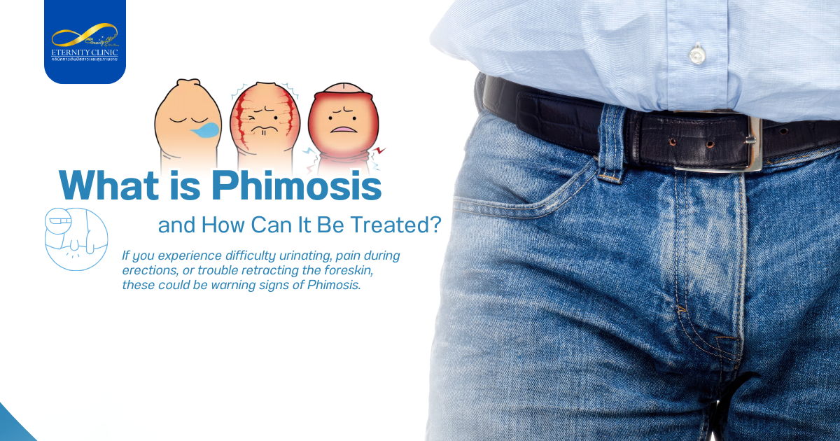What is Phimosis and How Can It Be Treated? - ETERNITY CLINIC by M.D ...